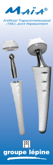 Daumensattelgelenkarthrose (Rhizarthrose)
